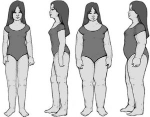 Your Body Type and Cellulite - Medshape Weight Loss Clinics